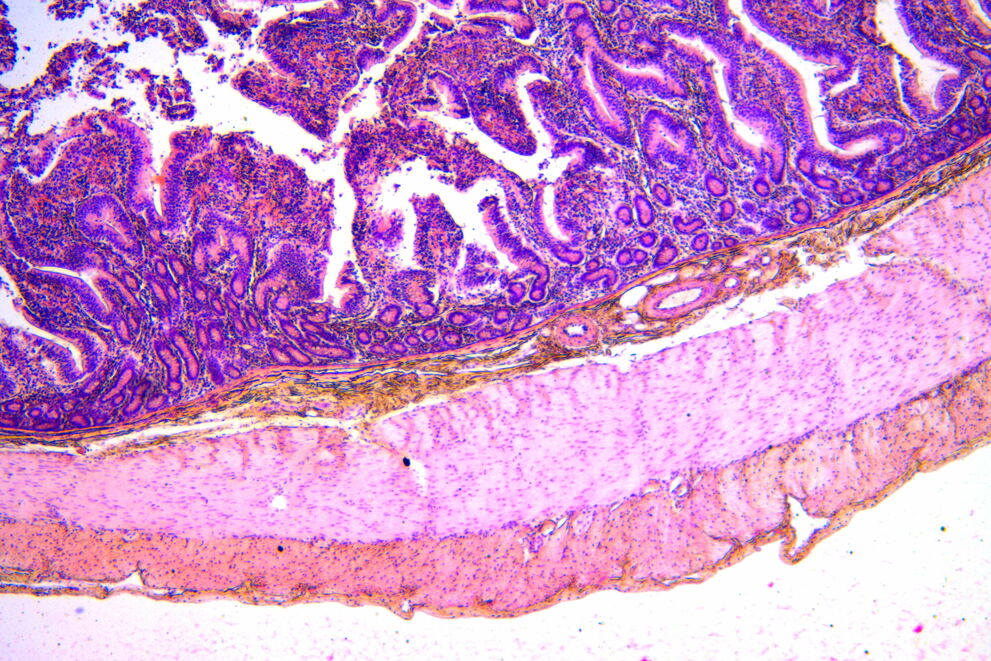 Tinción H E En Microscopía